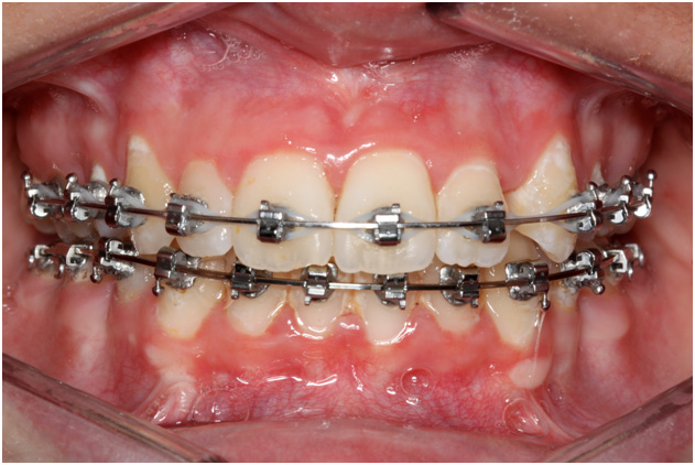 Orthodontie Centre Dentaire Lévis Les Rivières